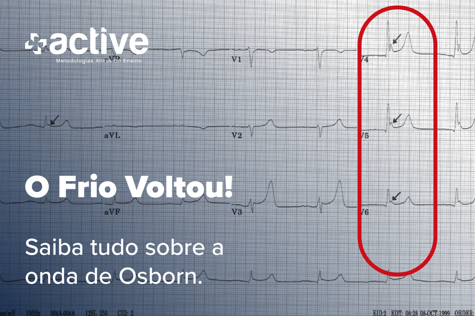 O Frio voltou! Saiba tudo sobre a onda de Osborn. - Blog da Active